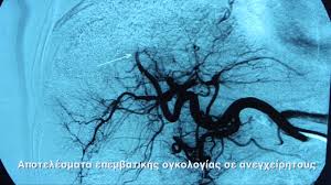 ΕΠΕΜΒΑΤΙΚΟΣ ΑΚΤΙΝΟΛΟΓΟΣ ΟΓΚΟΛΟΓΟΣ ΕΠΕΜΒΑΤΙΚΟΙ ΑΚΤΙΝΟΛΟΓΟΙ ΟΓΚΟΛΟΓΟΙ ...